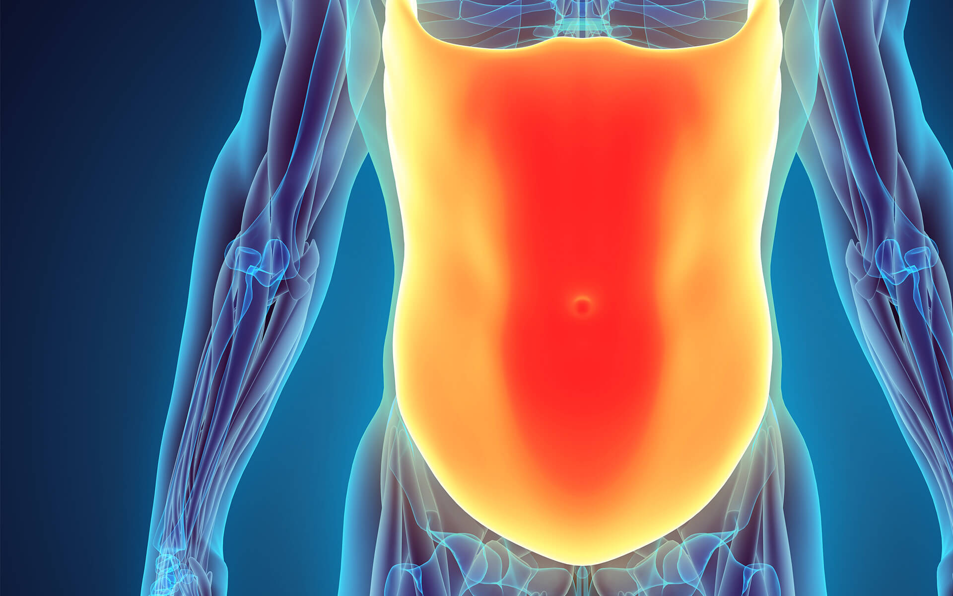Chronic Hernia: Symptoms, Diagnosis, & Treatments | IFAR