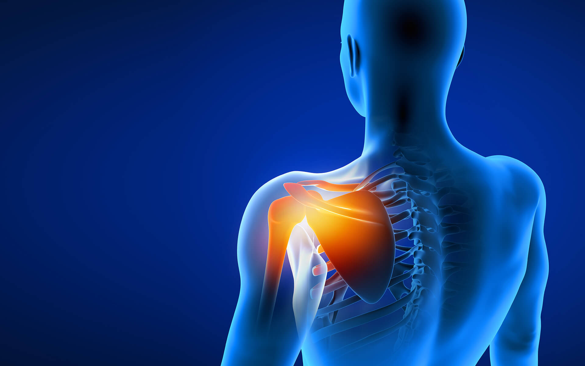 Brachial Plexus Injury | Symptoms Treatment & Causes | IFAR