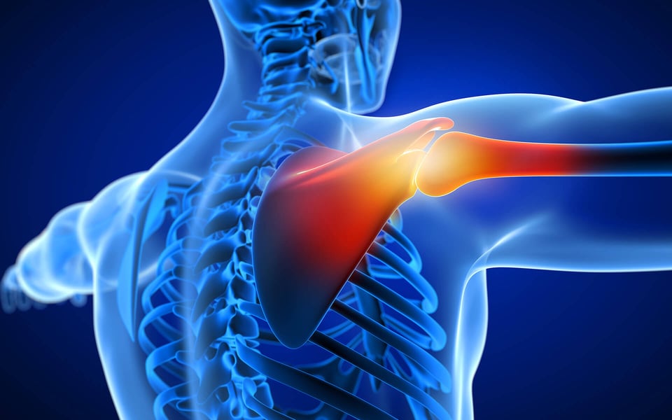 Brachial Plexus Injury | Symptoms Treatment & Causes | IFAR