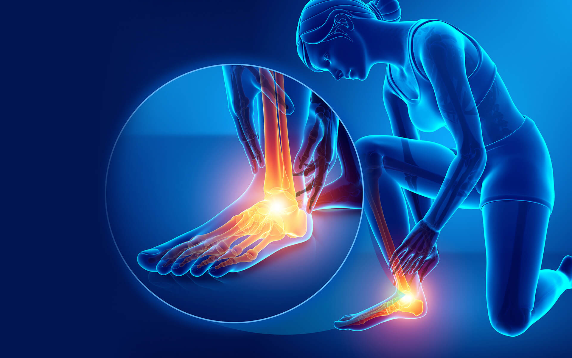 Foot Drop Overview: Symptoms, Diagnosis, & Treatments | IFAR