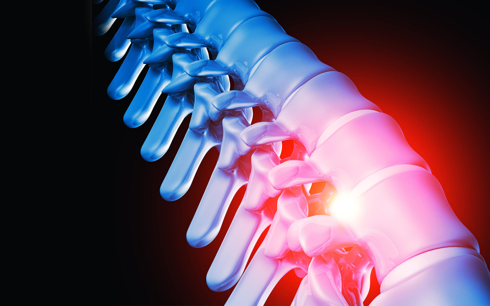 Core Muscle Injury: Causes Symptoms & Diagnosis | IFAR