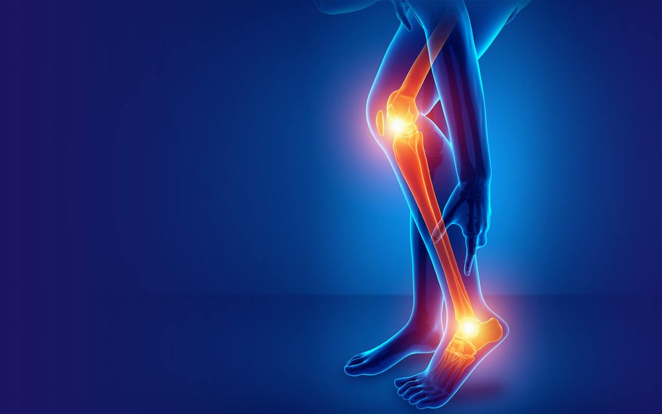 Nerve Compression Syndrome of the Extremities | IFAR