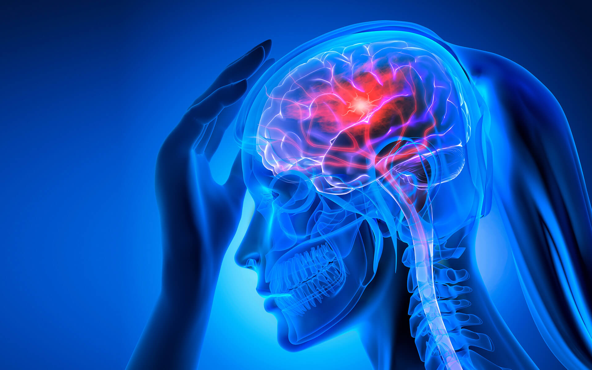 Post-Stroke Treatment: Symptoms & Diagnosis | IFAR