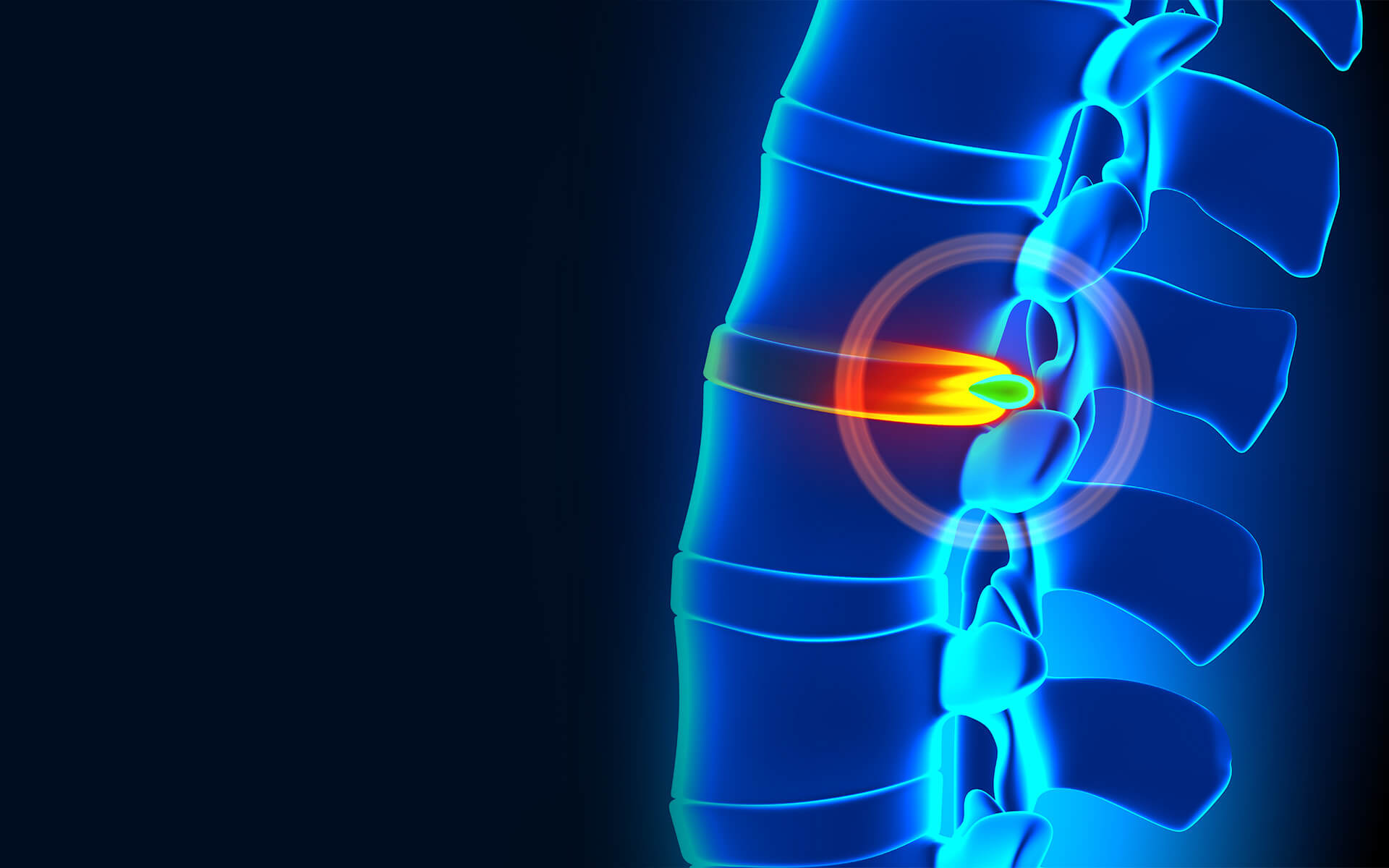 Core Muscle Injury: Causes Symptoms & Diagnosis | IFAR